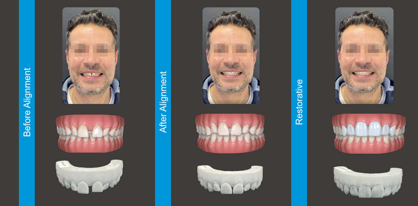 Digitalisierung in der Zahnmedizin: Software zum perfekten Lächeln – ZWP online – das ...